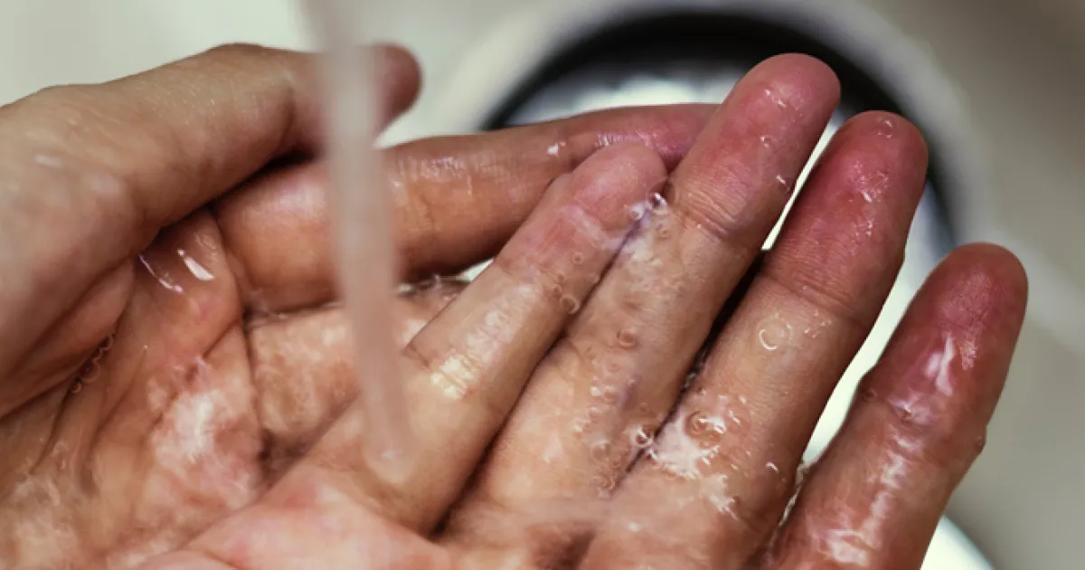 The ins and outs of proper handwashing at your vet clinic | Tuttnauer